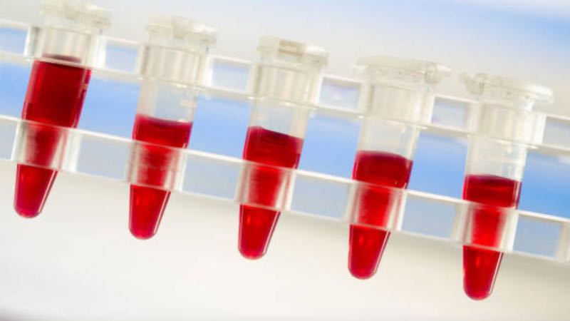 Parsortix method: new applications for circulating tumour cells