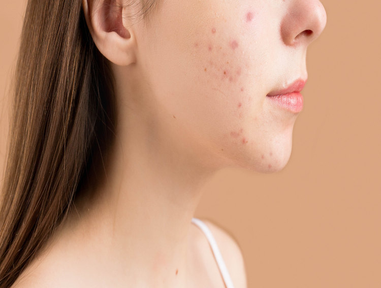 Sanofi to acquire Principia Biopharma